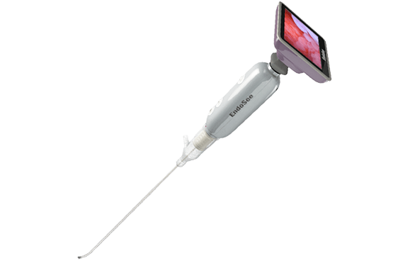 All-in-One Portable, In-office Hysteroscopy Device