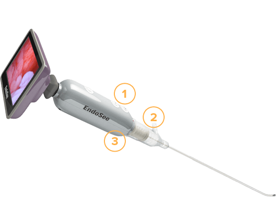 All-in-One Portable, In-office Hysteroscopy Device