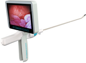 Direct Visualization for Diagnosis of AUB, Save Time, Resources